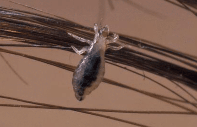 Ciclo Di Vita Dei Pidocchi